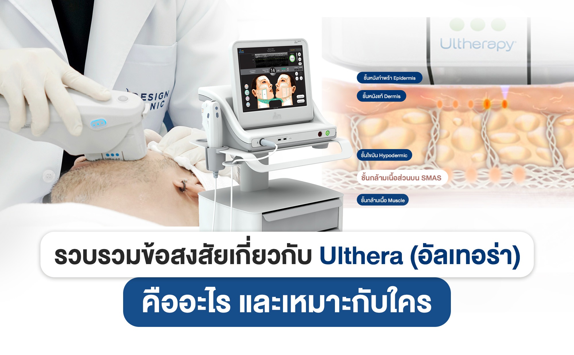 รวบรวมข้อสงสัยทั้งหมดเกี่ยวกับ Ulthera คืออะไร เหมาะกับใคร